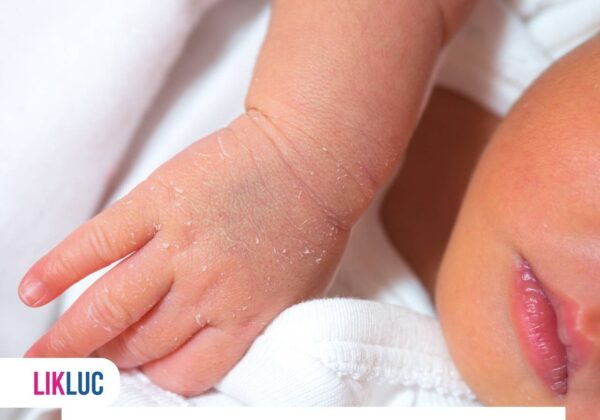 Vérnix caseoso em bebês: entenda o que é, sua função e mais!